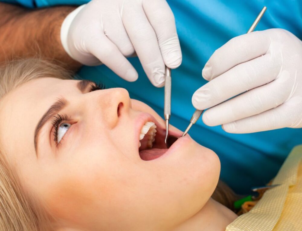 Things About Dissolvable Dental Stitches | Icard & Strein Family Dentistry